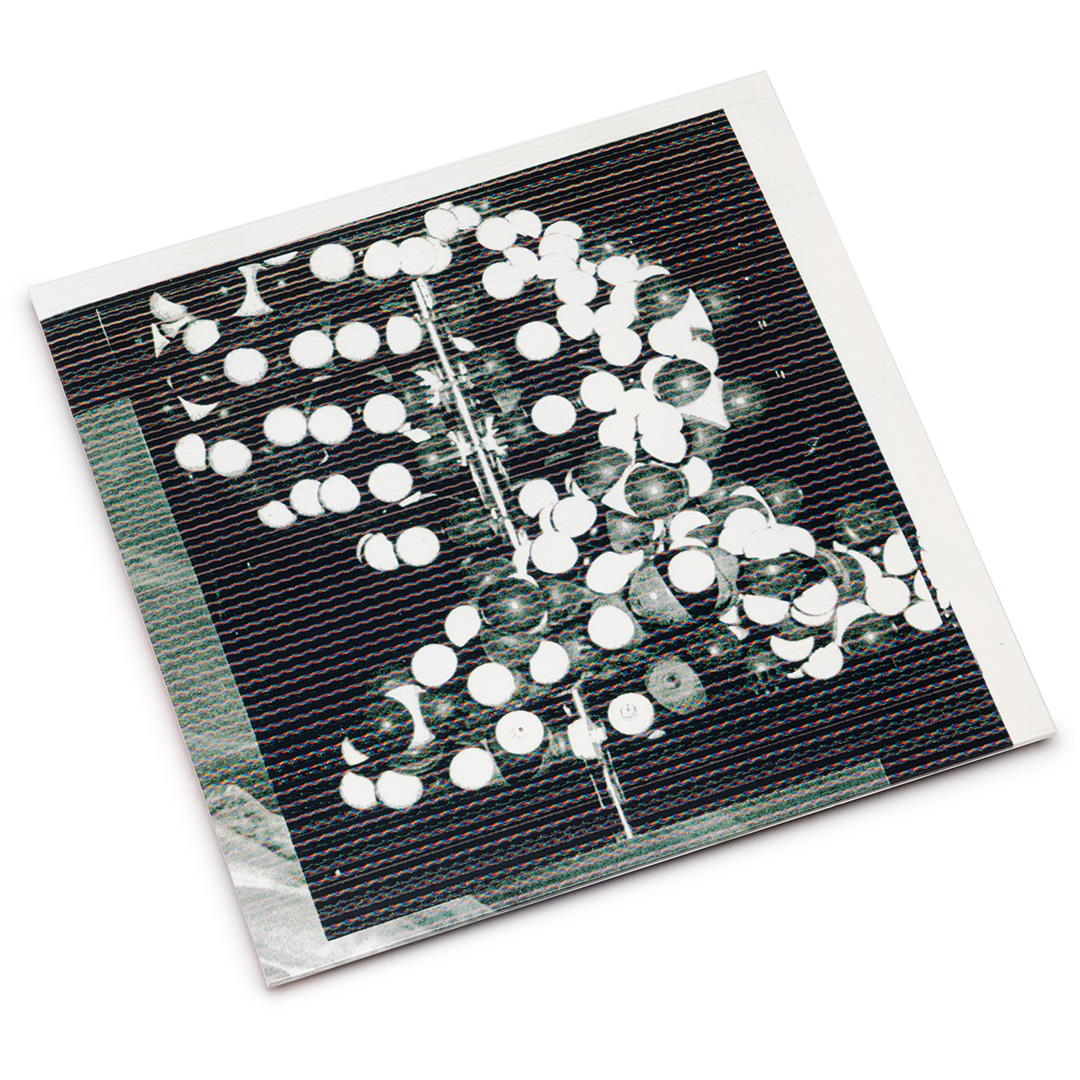 Smegma, L'Autopsie A Révélé Que La Mort Était Due A L'Autopsie ...